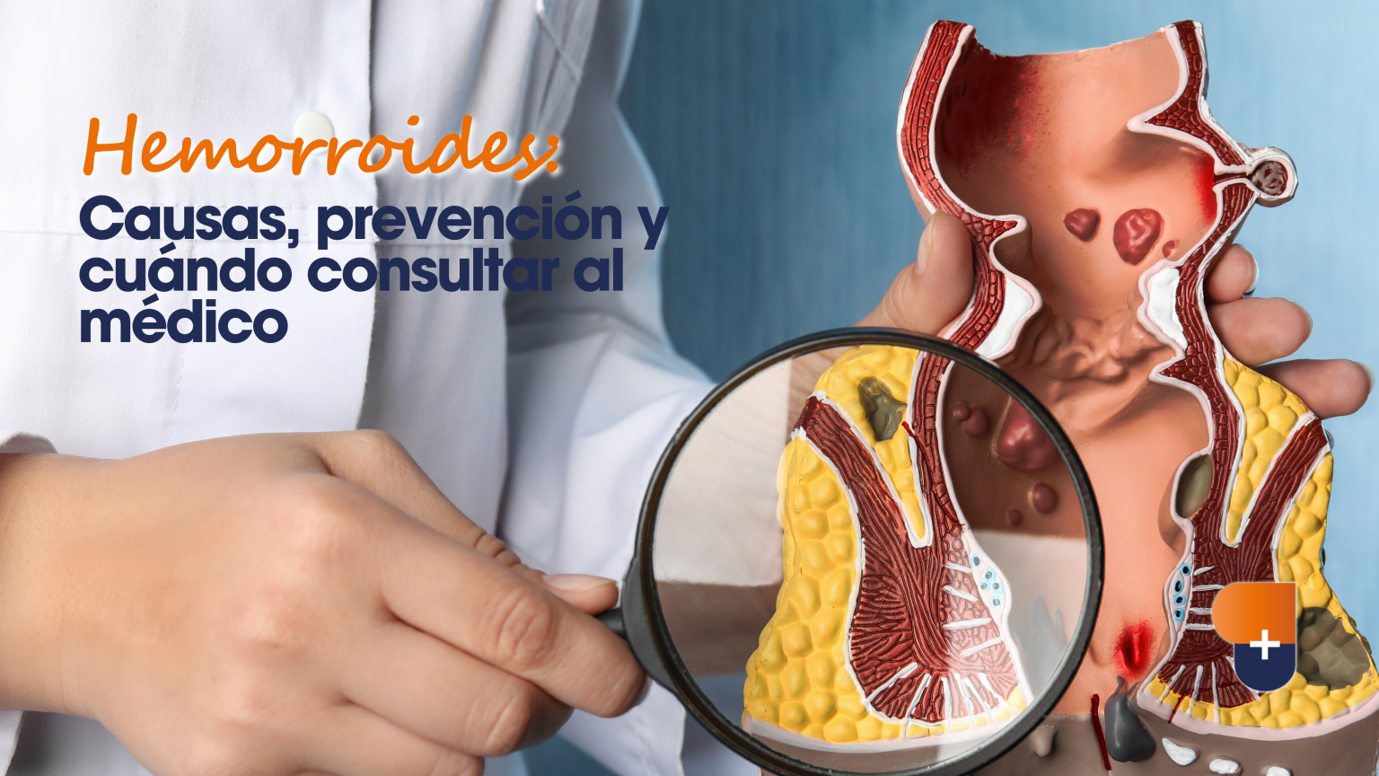 Hemorroides: Causas, prevención y cuándo consultar al médico ...